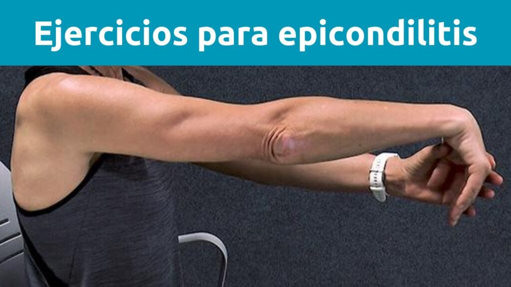 "¿Sufres de dolor en el codo? Aprende sobre la epicondilitis y cómo ...